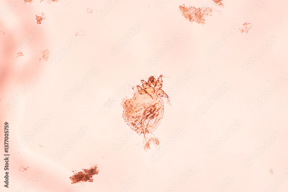 Image of pubic lice in microscopy from urine specimen.Pthirus pubis or ...