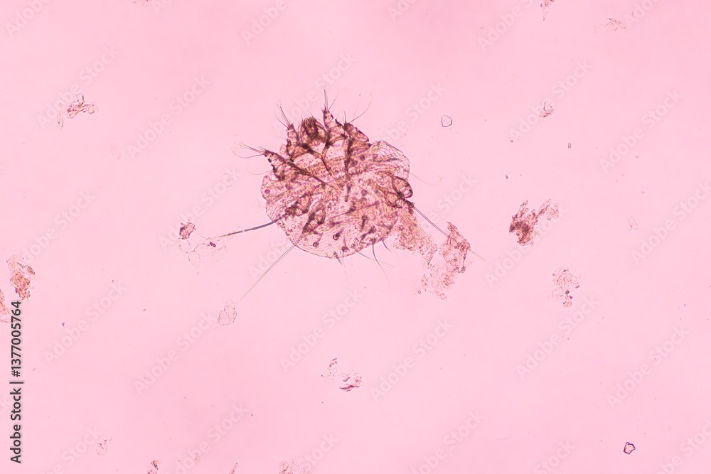 Foto de Stock Image of pubic lice in microscopy from urine specimen ...