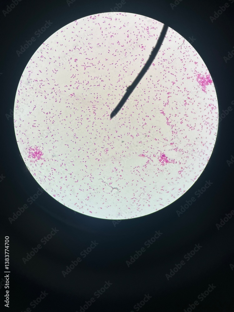 Gram stain micrograph of Gram-negative bacteria under a light ...