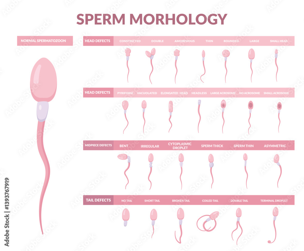 Sperm morphology count type educational medical scheme vector flat ...