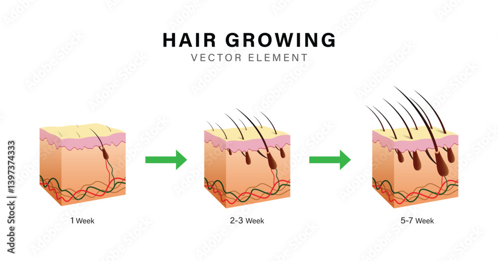 Anatomical training poster. Hair growth phase step by step. Stages of ...