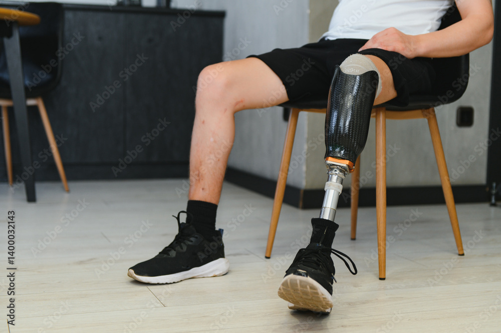 Man amputee with prosthetic leg disability on above knee transfemoral ...