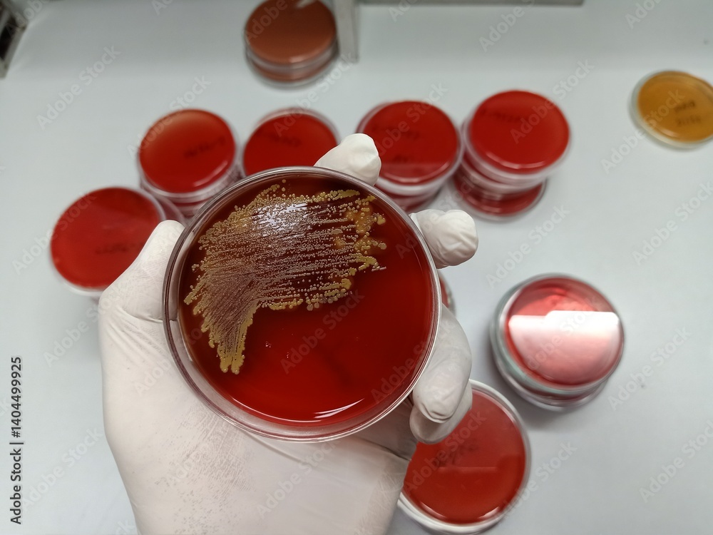 Microbiologist hold Bacteria culture growth on a petri dish in the ...