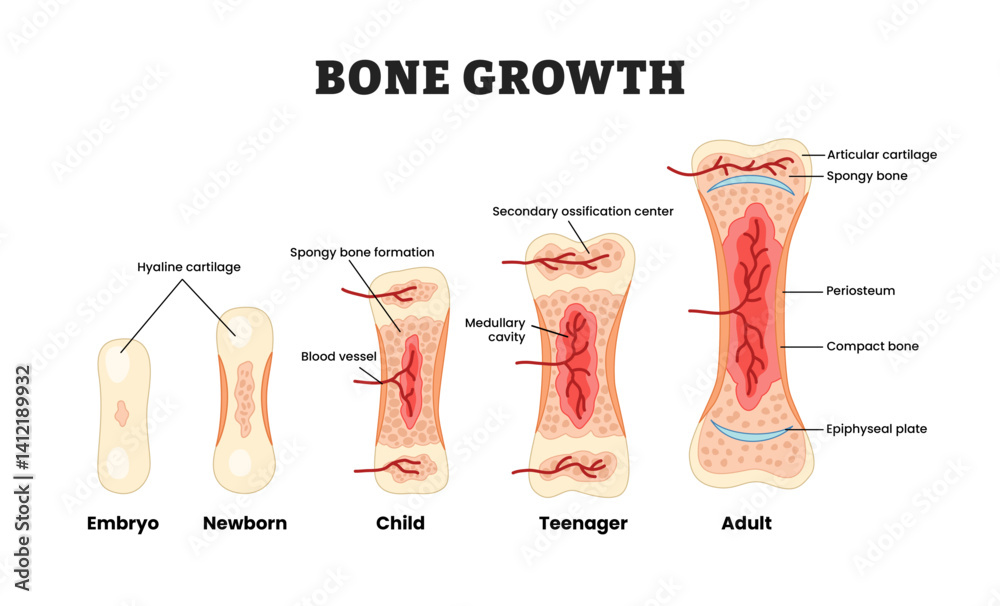 Bone growth stages progress process development, educational medical ...