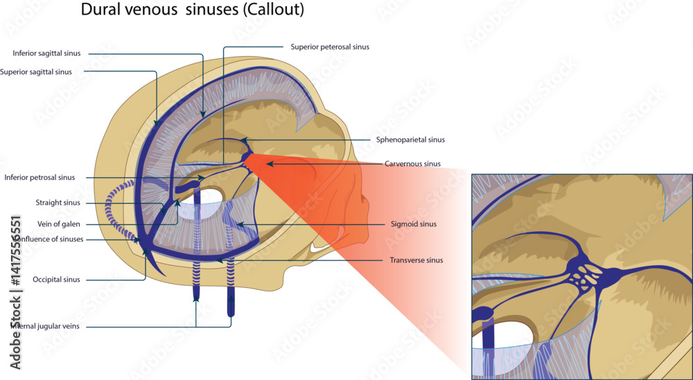 Dural venous sinuses drain blood from the brain and empty into the ...