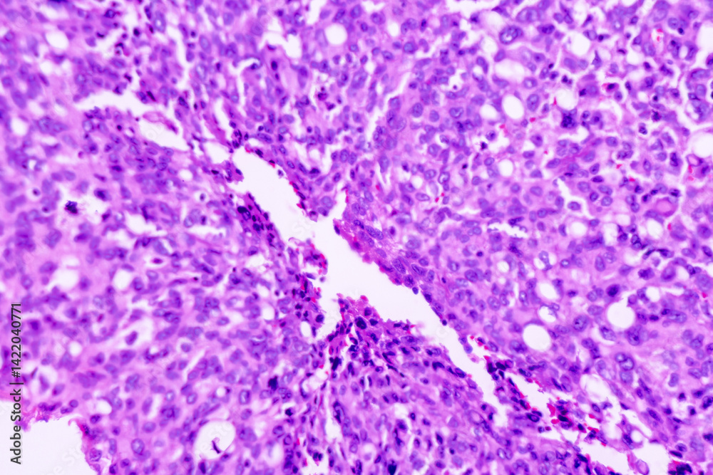 Backgrounds of human cells tissue of lung human under the microscope in ...