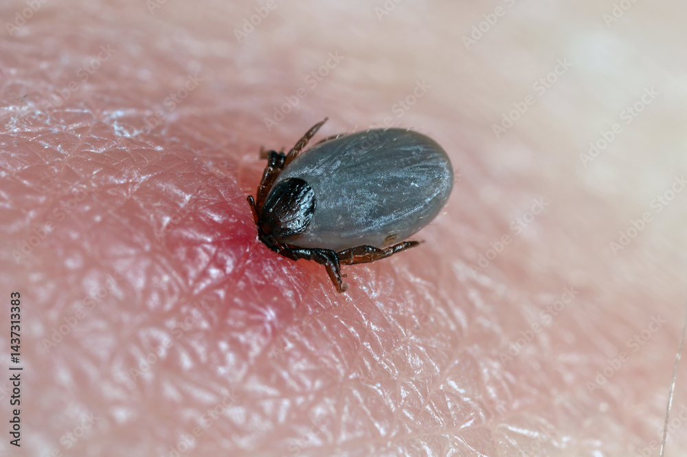 European castor bean tick, European sheep tick (Ixodes ricinus), tick ...