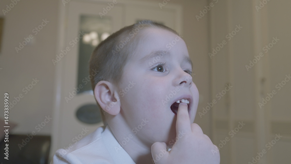 Child Wiggling His Front Milk Teeth. Child Showing His Milk Tooth ...