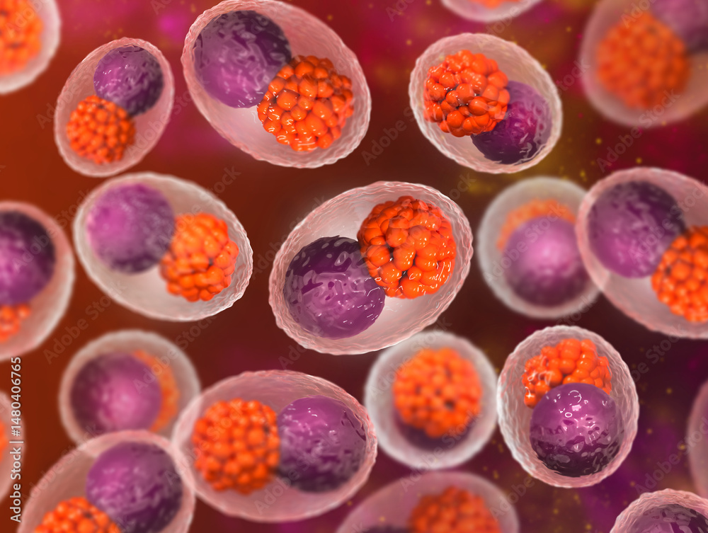 Medical background, Chlamydophila pneumoniae, bacteria from the ...