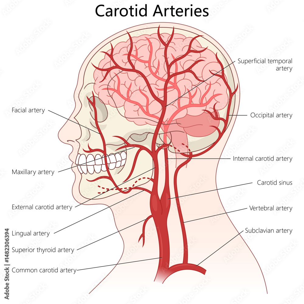 Carotid Arteries And Their Major Branches In The Head And Neck Used