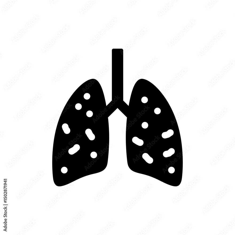 Lung cancer spread spots medical oncology anatomy image Stock Vector ...