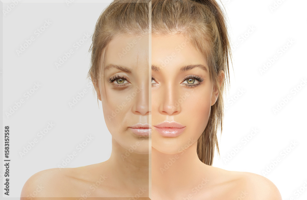 Signs of skin aging,signs of premature aging, Wrinkles and fine lines ...