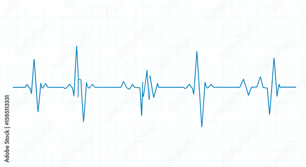 Heartbeat pulse line on graph paper background with blue ecg tracing ...