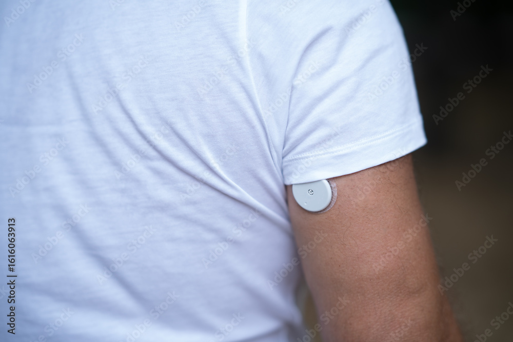 Man Wearing Freestyle Libre Sensor on Arm Stock Photo | Adobe Stock