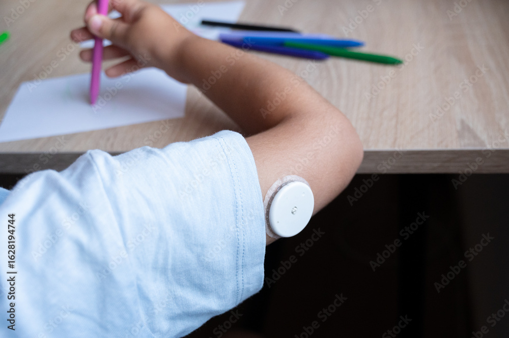 Child drawing with continuous glucose monitoring system on arm Stock ...