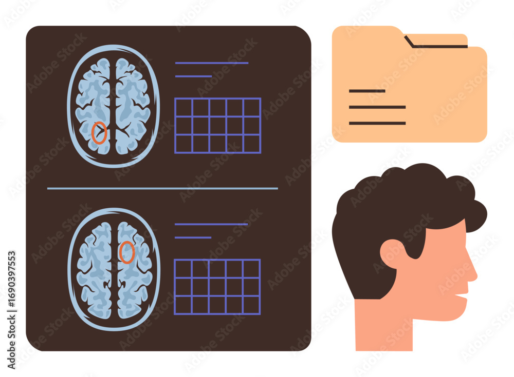 Brain scan with highlighted areas, patient profile side view, chart ...