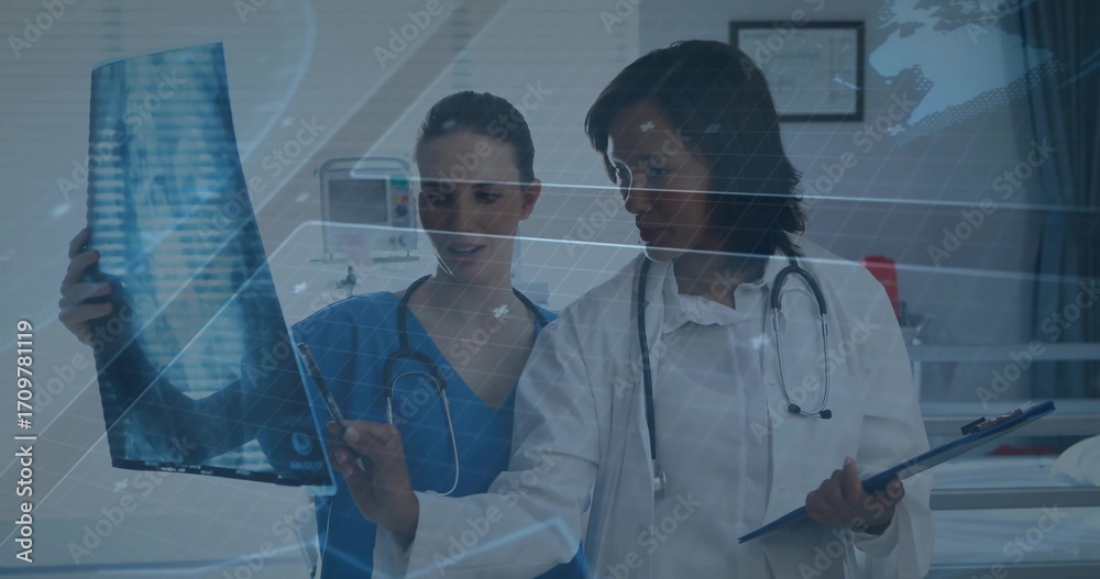 Reviewing chest X-ray film staff wearing scrubs, lab coat in hospital ...