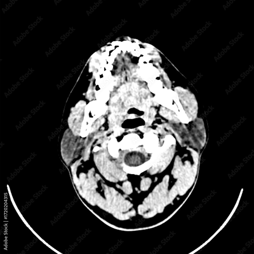 Medical CT Scan and X-Ray Imaging of Human Skull and Head Anatomy の Stock フォト | Adobe Stock