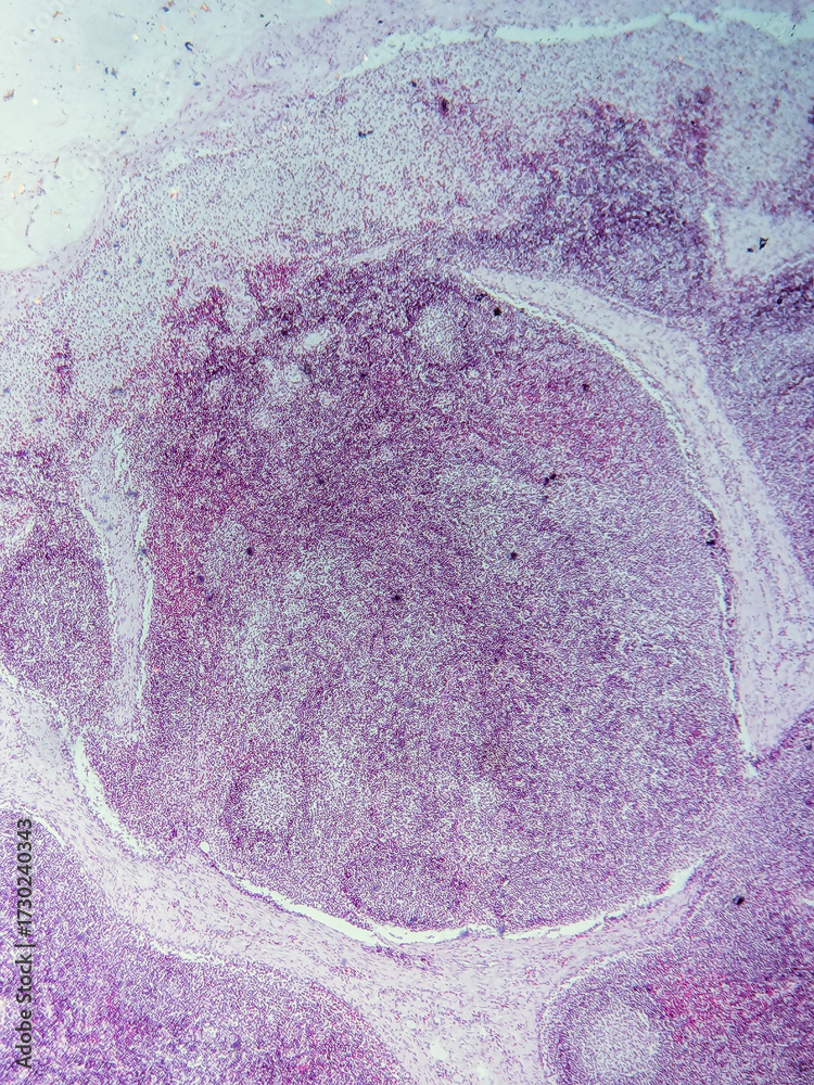 Pig Lymph Node Histology Stock Photo | Adobe Stock