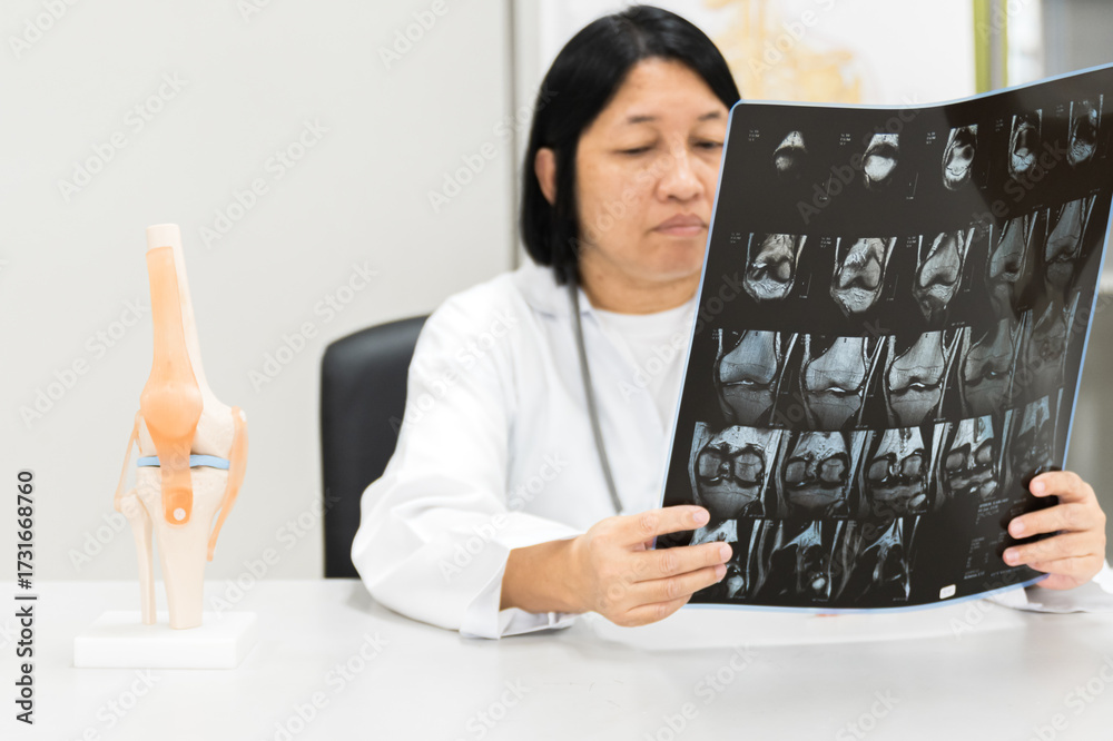 Doctor hold patient bone x-ray film before surgery.Image MRI and CT ...