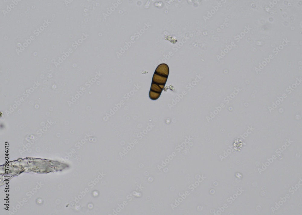 soil microorganisms under a microscope including amoeba, flagellates ...