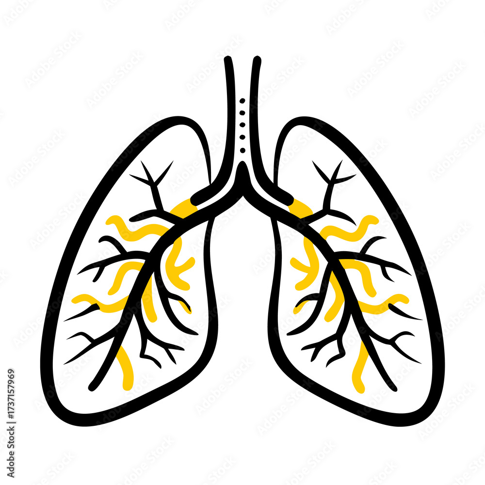 Stylized black and yellow human lungs with branching bronchioles ...