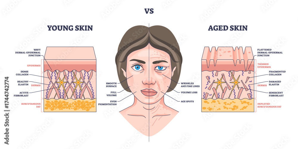 Young vs aged skin shows differences in collagen, elasticity, and ...