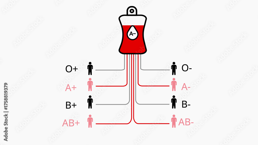 Blood Donation Compatibility Chart Featuring an A Negative Blood Bag ...