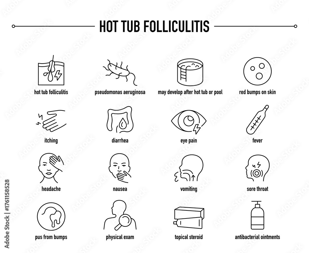 Hot Tub Folliculitis symptoms, diagnostic and treatment vector icon set ...