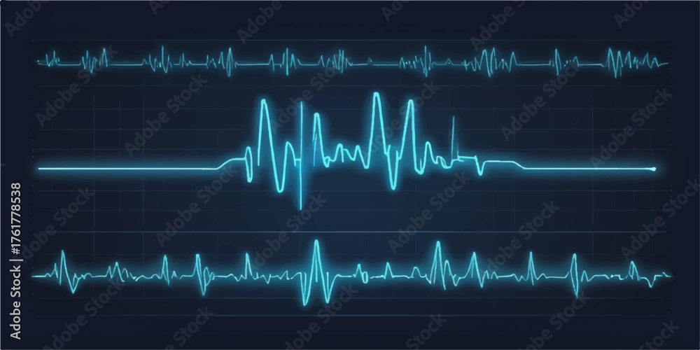 Medical heartbeat pulse graph on an ECG monitor illustrates the rate ...