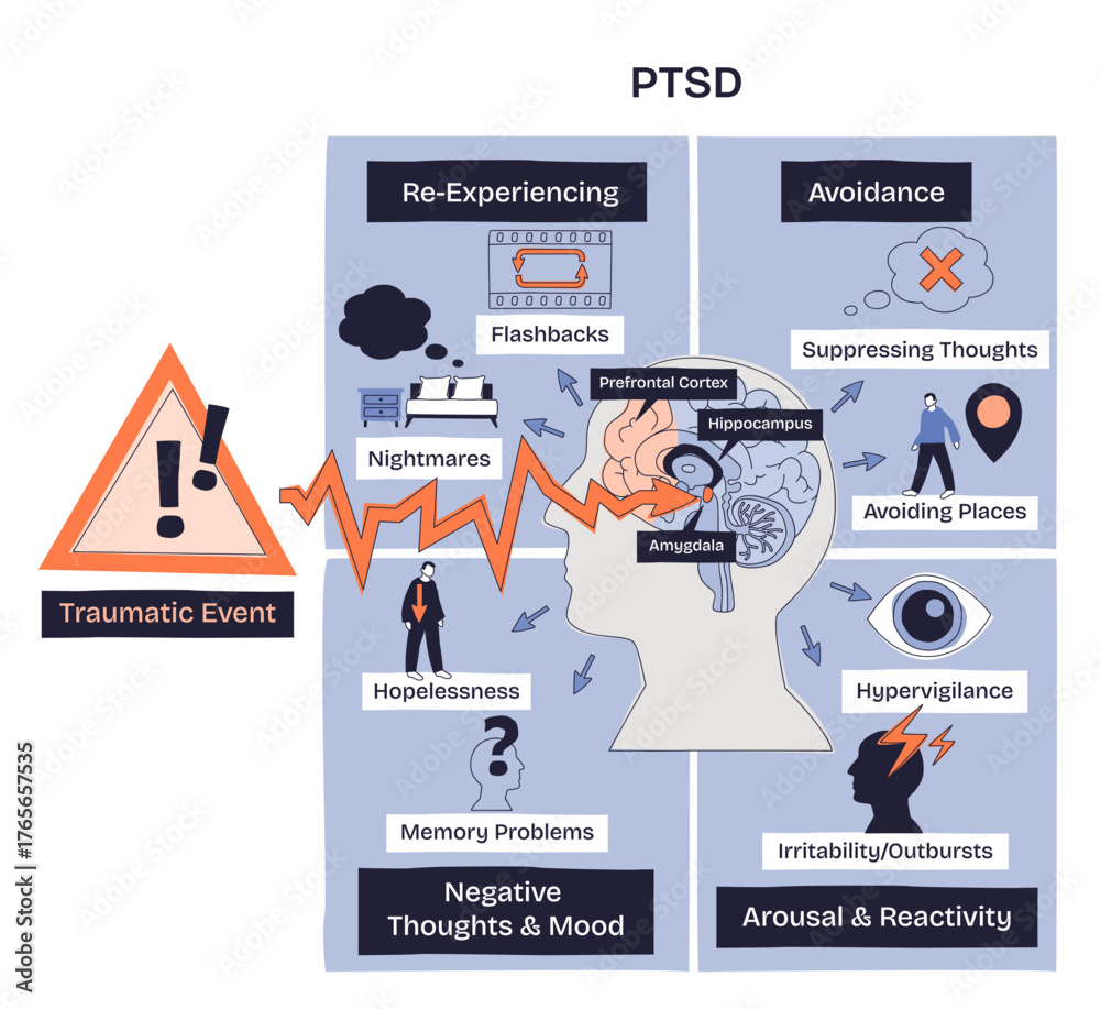 PTSD brief overview shows brain, warning triangle, and symptom icons ...