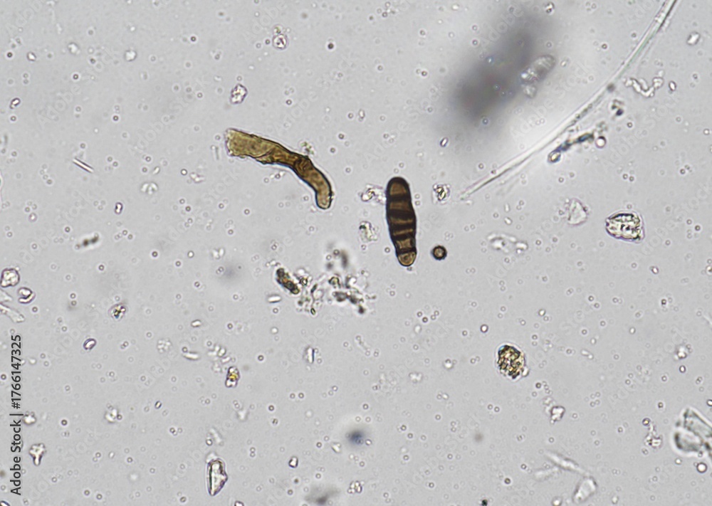 soil microorganisms under a microscope including amoeba, flagellates ...
