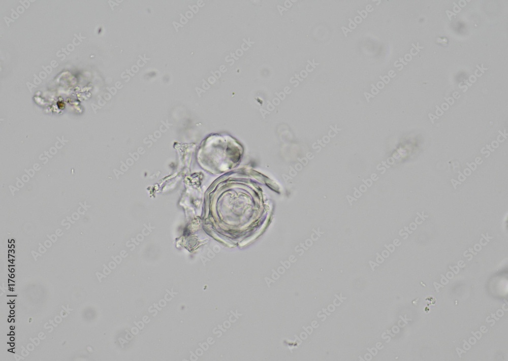 soil microorganisms under a microscope including amoeba, flagellates ...