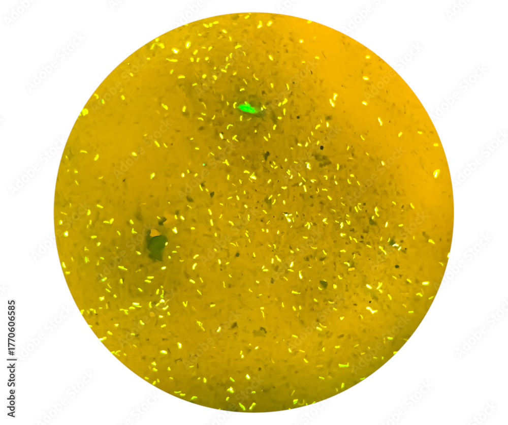 Microbacterium Tuberculosis Bacteria (MTB) Auromin O stain analysed by ...