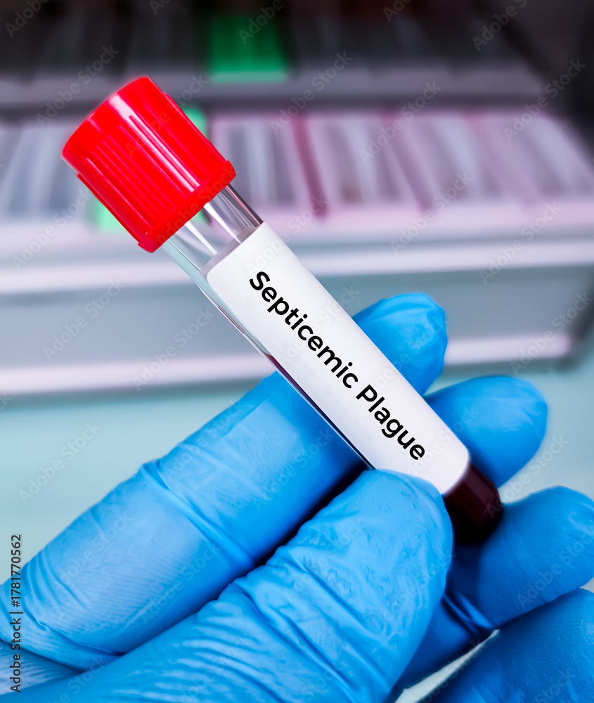 Foto de Stock Blood sample for Plague test. It's one of three types of ...
