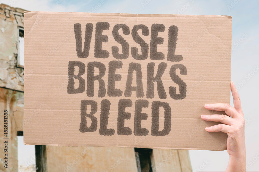 "Vessel Breaks Bleed" A burst vessel leads to dangerous bleeding ...