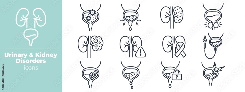 Medical urinary system icons showing kidney stones, bladder infections ...