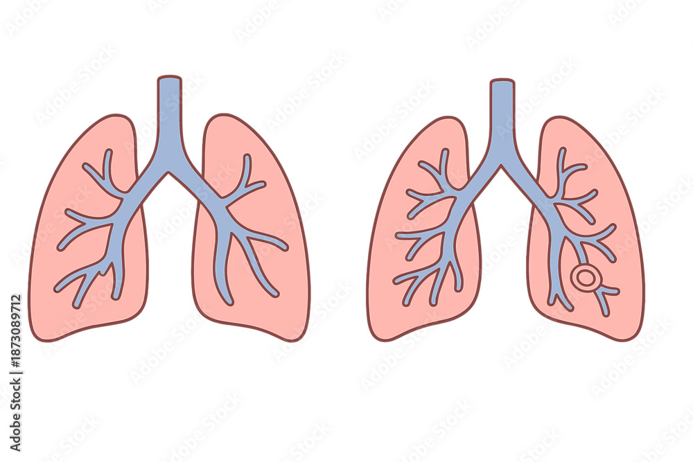 Visual representation of human lungs showing anatomy and branching ...