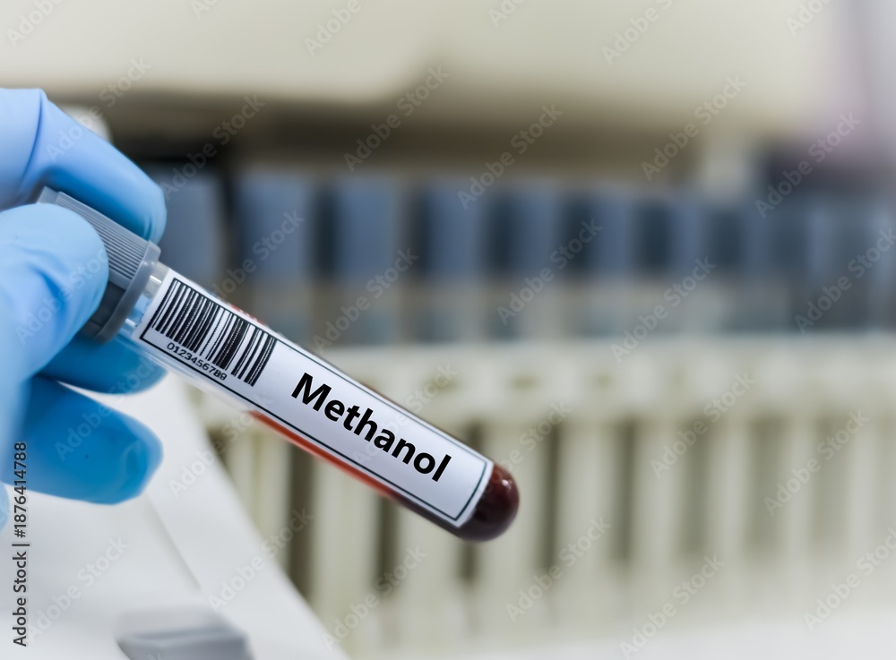 Blood sample tube for methanol test analysis. Stock Photo | Adobe Stock