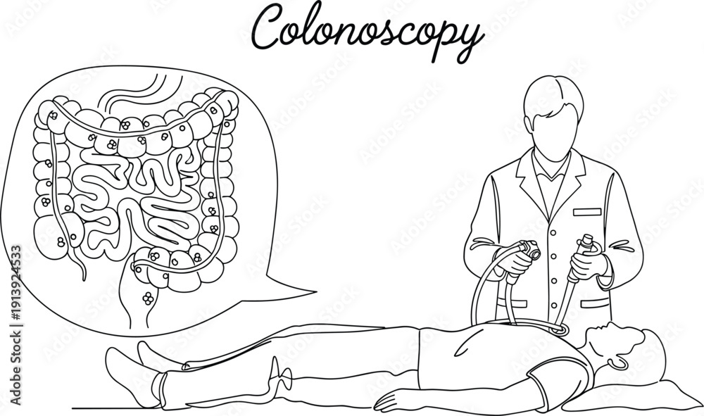 Colonoscopy Medical Procedure Illustration Showing Doctor Performing ...