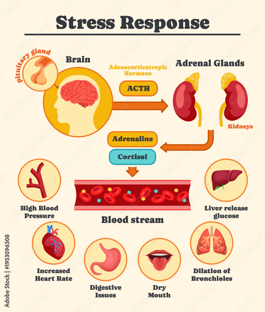 Vector de Stock Stress response anatomical scheme. Medical diagram ...