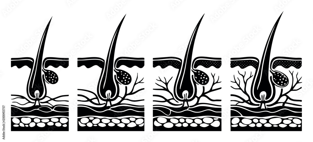 Hair growth cycle stages diagram outlining human skin cross-section ...