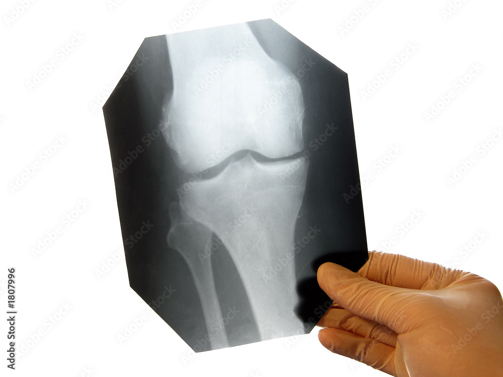 x-ray knee diagnostics Stock Photo | Adobe Stock