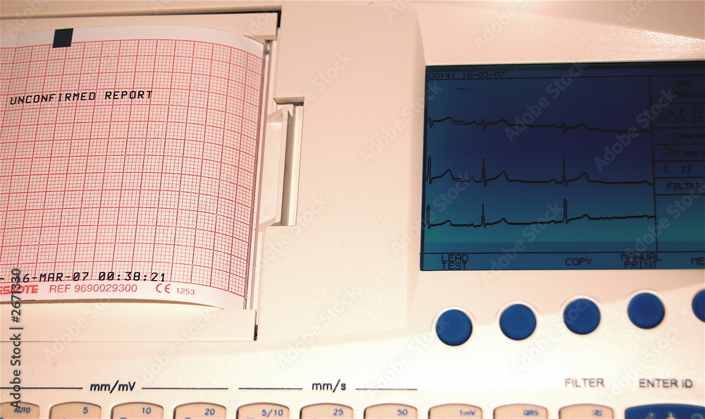 ecg Stock Photo | Adobe Stock