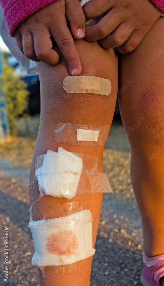 Little girl pointing at her leg covered with band aids Stock-Foto ...