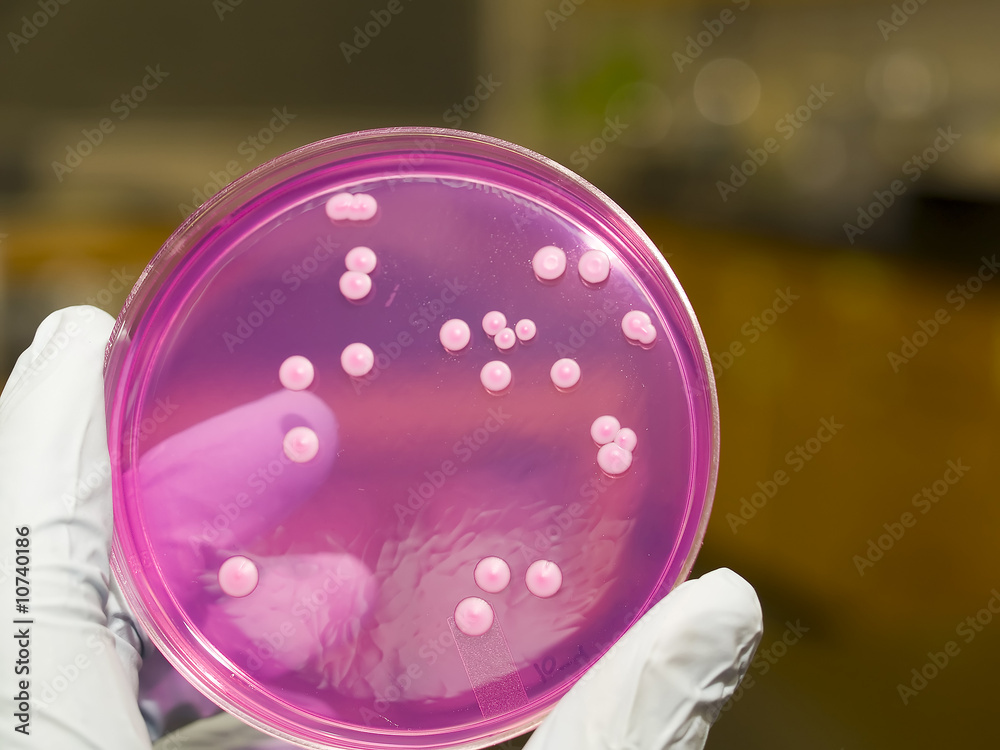 Bacterial colonies Stock Photo | Adobe Stock