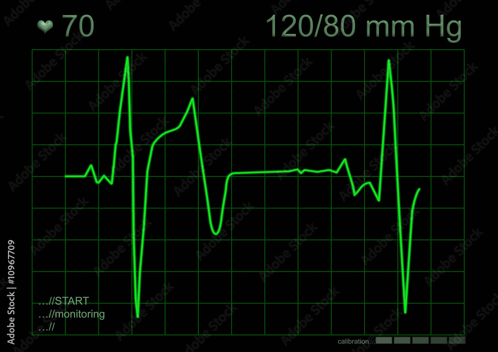 ECG - illustration Stock Illustration | Adobe Stock
