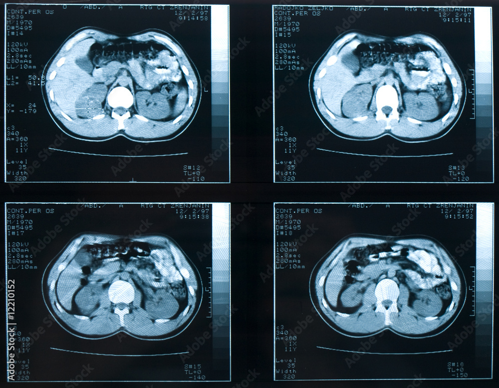 Film of MRI scans Stock Photo | Adobe Stock