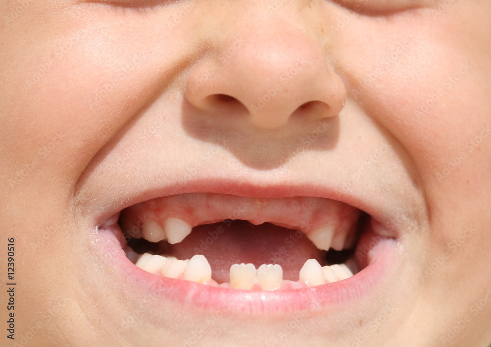 Child's toothless mouth Stock Photo | Adobe Stock