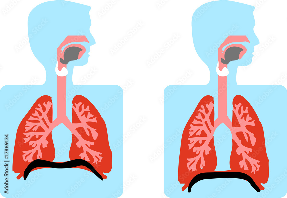 Anatomy Vector Medical illustration, human lung, Chest Cavity, p Stock ...
